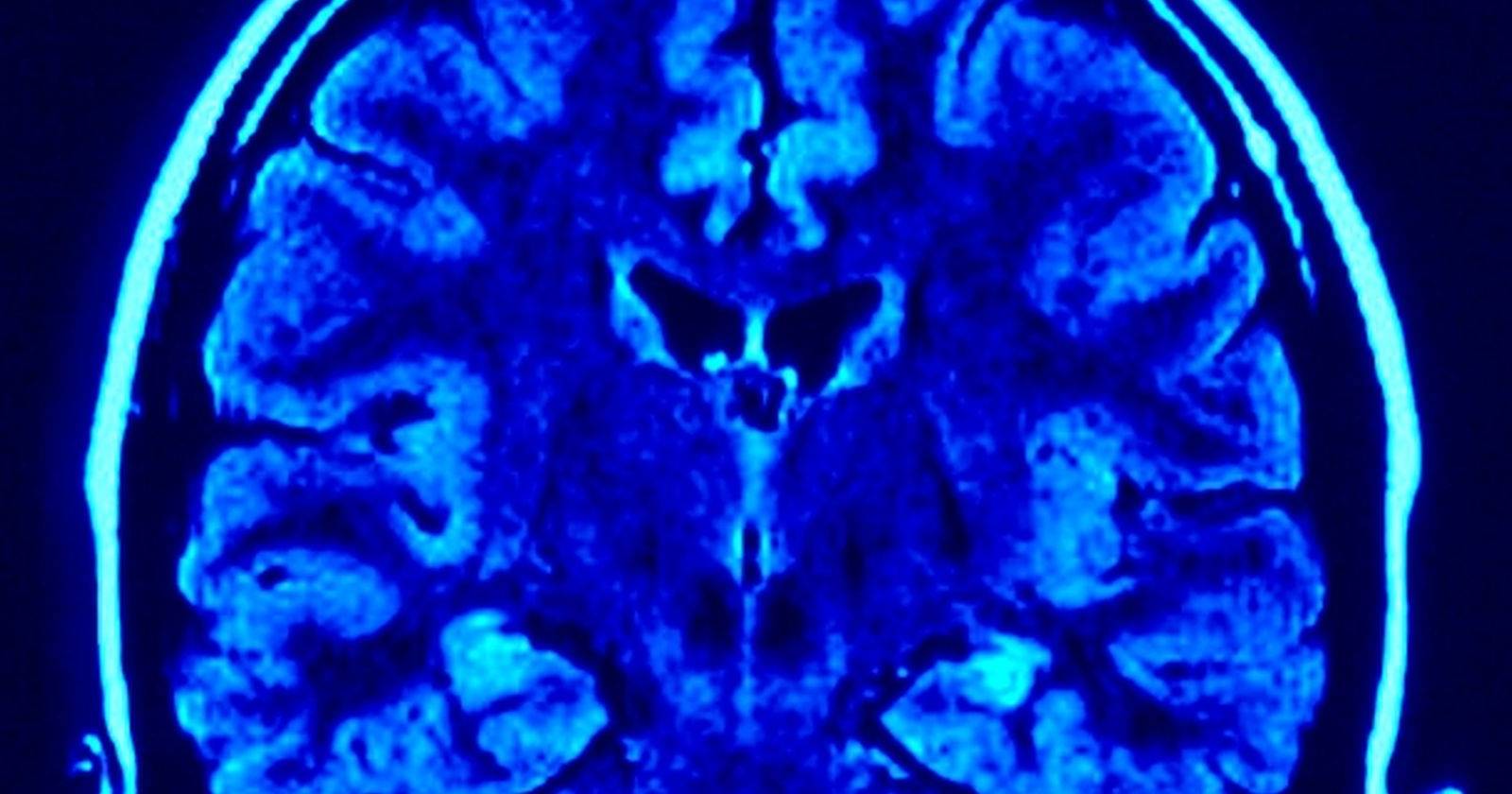 Plugging In Your Brain and Body - The Future Of Implanted Computers