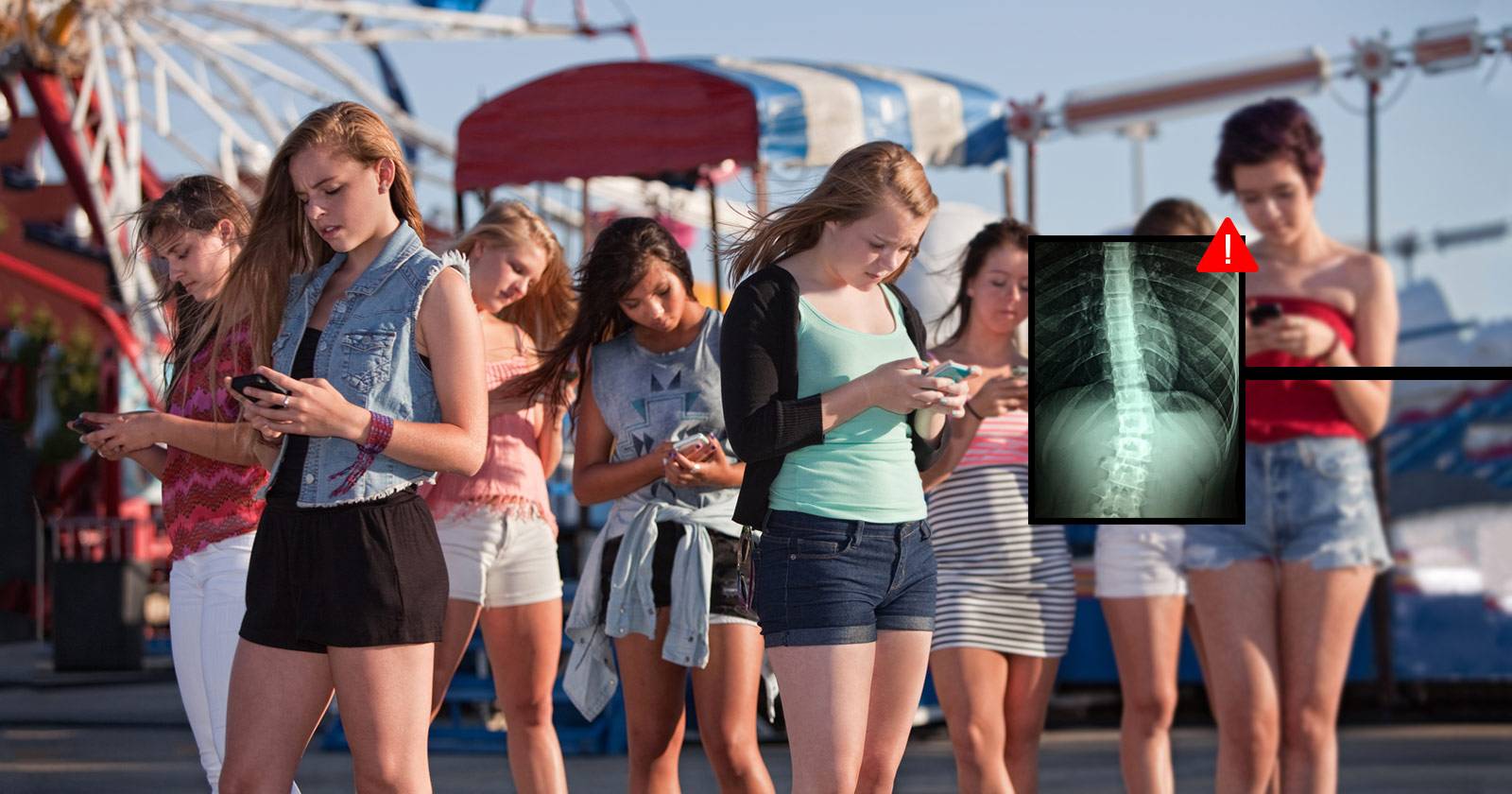 How to Fix Major Damage to Your Spine from Gadget Overuse