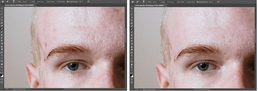 5 Blemishes You Can Easily Remove Using Photoshop