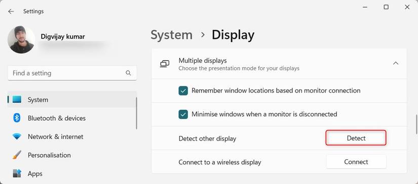 Windows 11 Second Monitor Not Detected: 5 Fixes