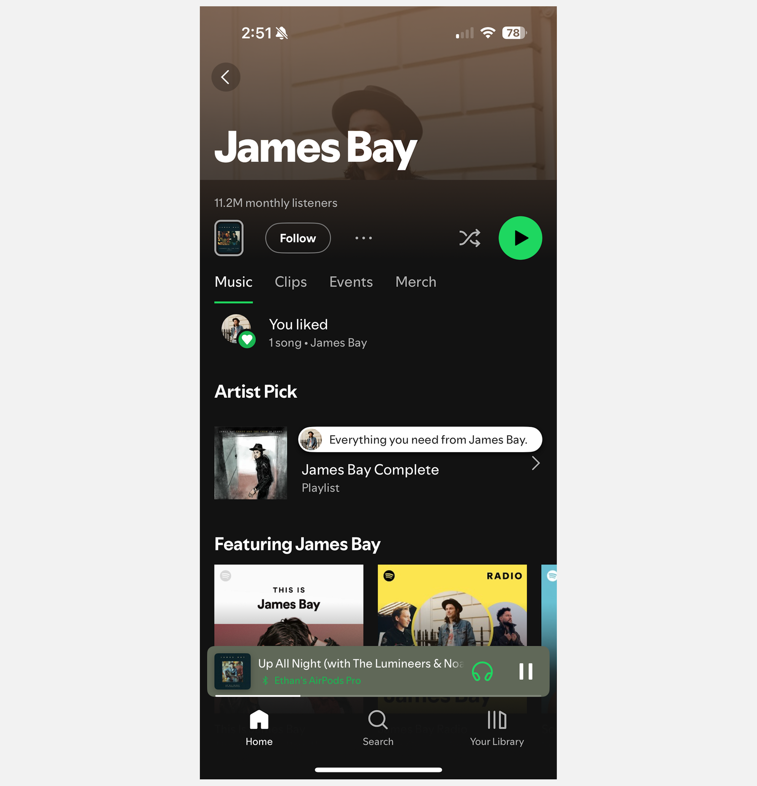 Spotify Albums and Discography Gone? You're Not Alone